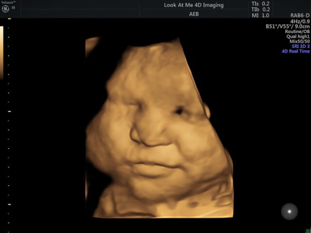 Ultrasound Packages | Personalized Prenatal Imaging | Look At Me 4D Imaging